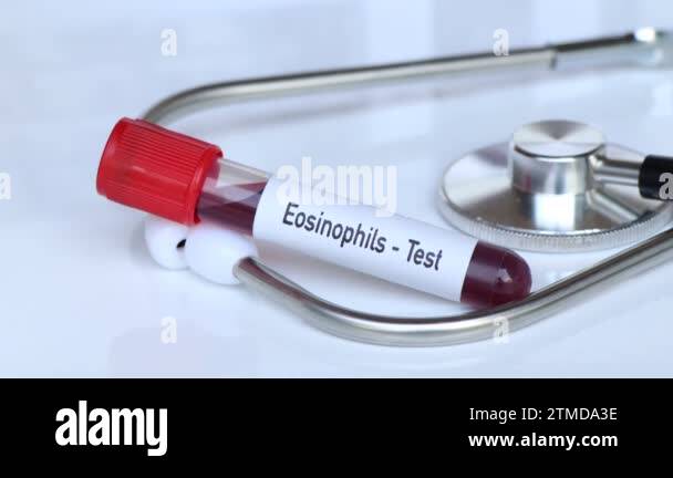 Eosinophils test Stock Videos & Footage - HD and 4K Video Clips - Alamy