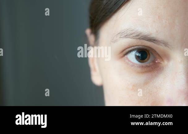 Close-up of a womans brown eye with dilated big pupil. Eye drops after ...