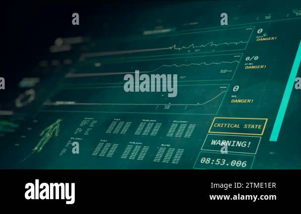 Clinical death and reviving on ICU monitor, patient lives ...