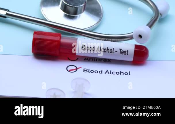 Blood alcohol test Stock Videos & Footage - HD and 4K Video Clips - Alamy