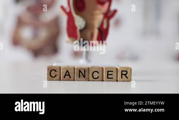 Word cancer on cubes on background of anatomical model of rectum. Colon ...