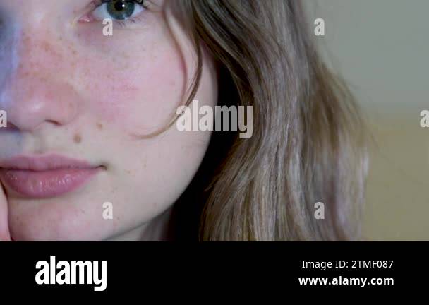 face of teenager girl with freckles close-up adolescence skin changes ...