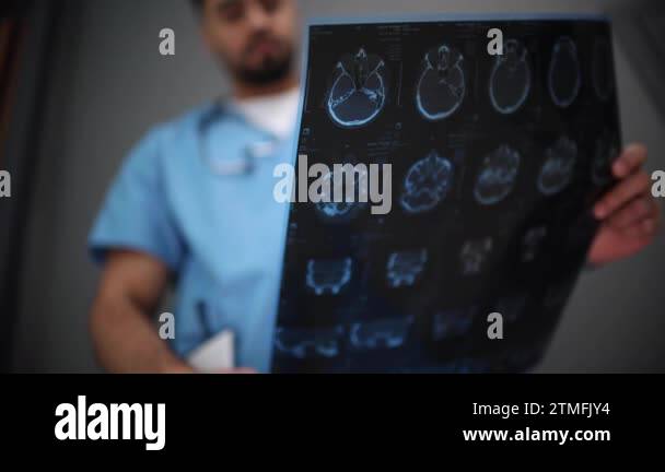 Doctor check x ray Stock Videos & Footage - HD and 4K Video Clips - Alamy