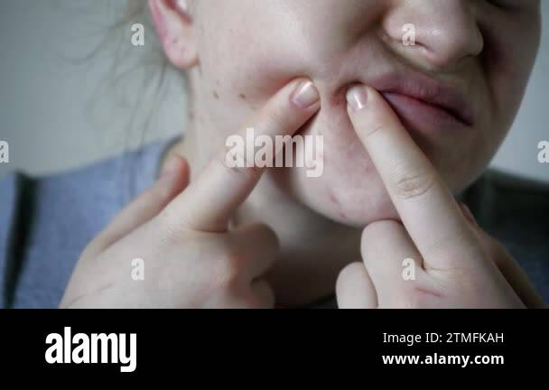 Bumpy nose Stock Videos & Footage - HD and 4K Video Clips - Alamy