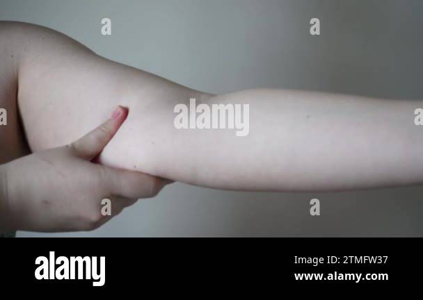 Light-skinned young woman with drooping arms. Sad bad body shape girl ...