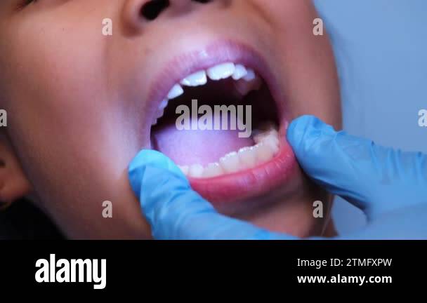 Close-up inside the oral cavity of a healthy child with beautiful rows ...