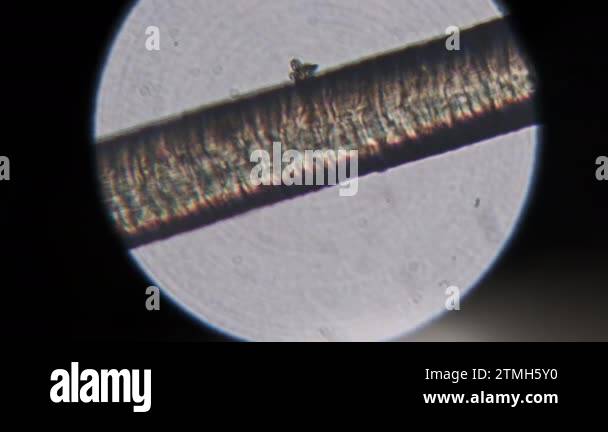 Human hair under a microscope. Microscopy of a single human hair from ...