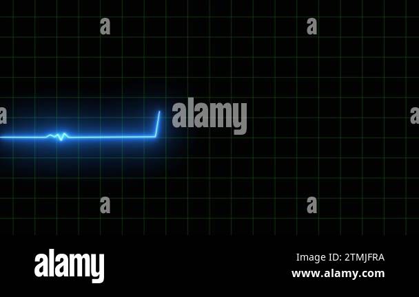 Heartbeat Monitor EKG Cardiogram animation. blue chart. Neon effect ...