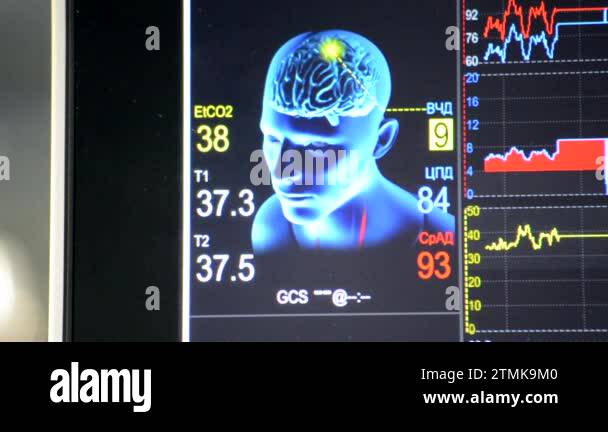 Patient monitor close-up. Monitor with different patient vital signs in ...