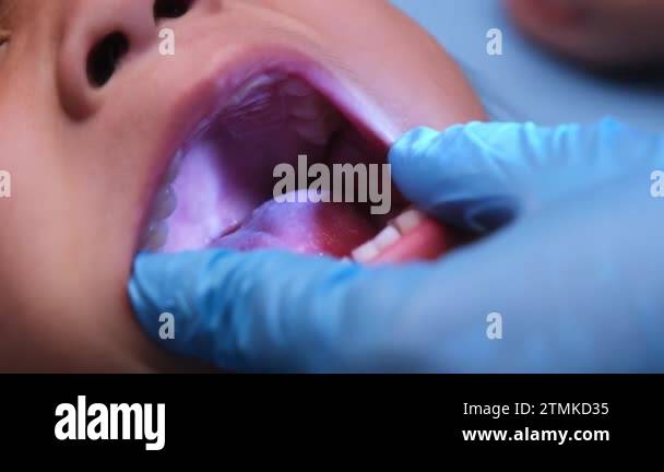 Close-up inside the oral cavity of a healthy child with beautiful rows ...