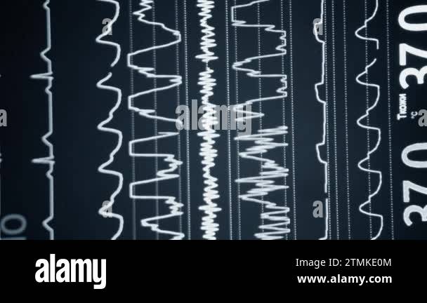 Modern patient monitor. Electronic Health Monitor displaying medical ...