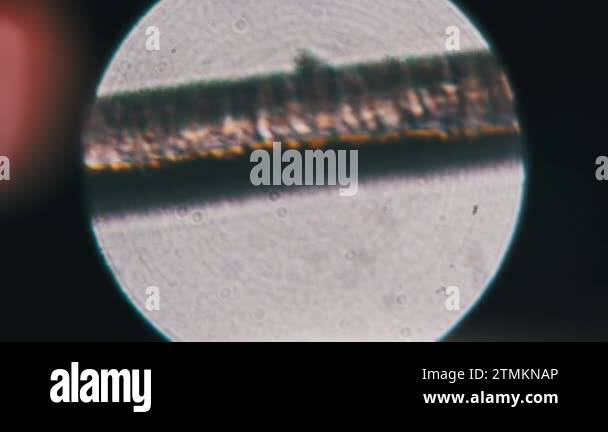Single Human hair under a microscope. Microscopy of human hair from the ...
