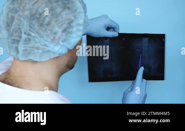 X-ray of a calculus in the kidney 8 mm. Stone in the ureter on x-ray. X ...