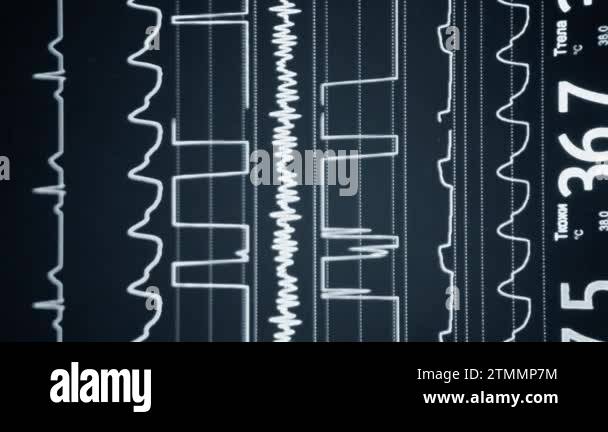 Modern patient monitor. Electronic Health Monitor displaying medical ...