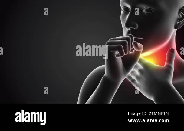 3d animation human body Man Suffering From pain in the neck sore throat ...
