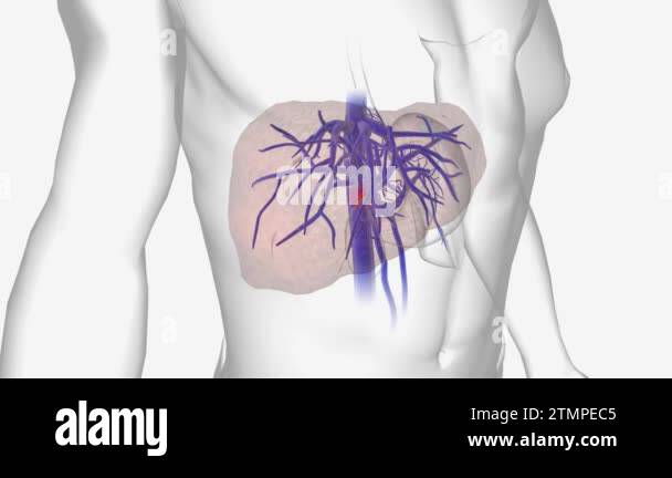Portal vein Stock Videos & Footage - HD and 4K Video Clips - Alamy