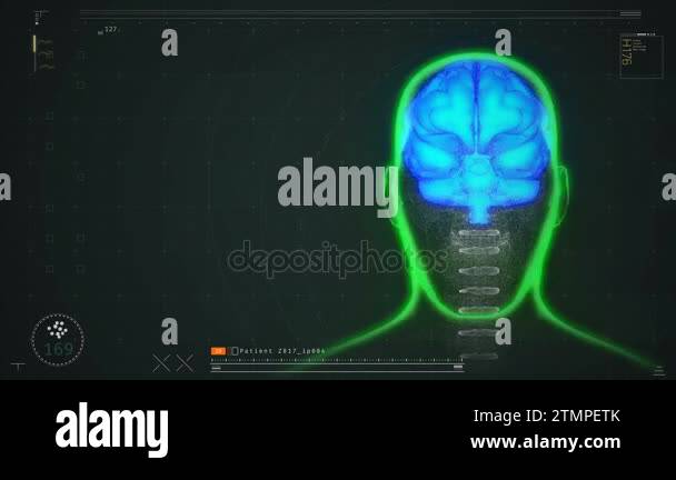 Patient's brain scan test results on screen, disease diagnostics and ...