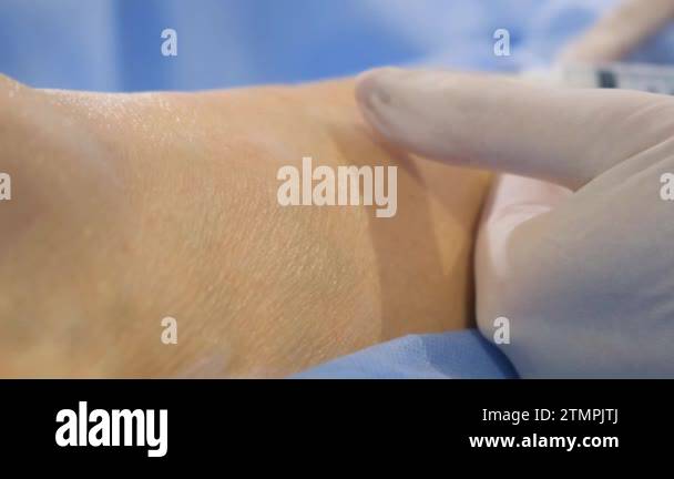 Preparation for injection anesthesia. Injection anesthesia. Treatment ...