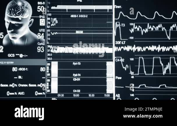 Patient monitor close-up. Monitor with different patient vital signs in ...