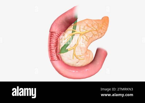 The pancreas is an elongated, tapered organ located across the back of ...