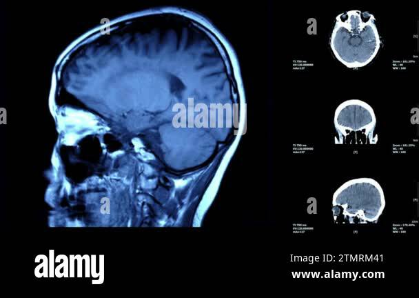 Magnetic waves brain Stock Videos & Footage - HD and 4K Video Clips - Alamy