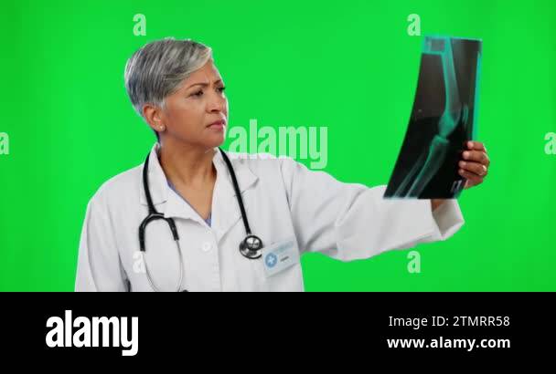 X ray, green screen and mature doctor analyzing results planning treatment and isolated in a ...
