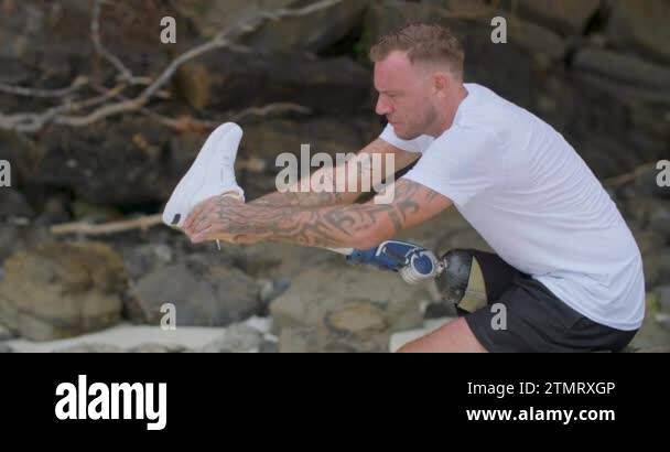 Man with artificial bionic legs prosthesis sitting on seaside, takes ...