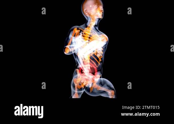 Back Pain spinal spine close-up animation Anatomy Body 3D Scan render ...