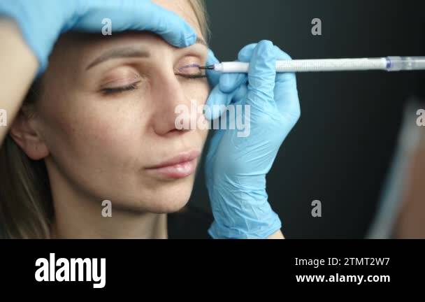 Process of putting marks on upper eyelid of young woman for plastic ...