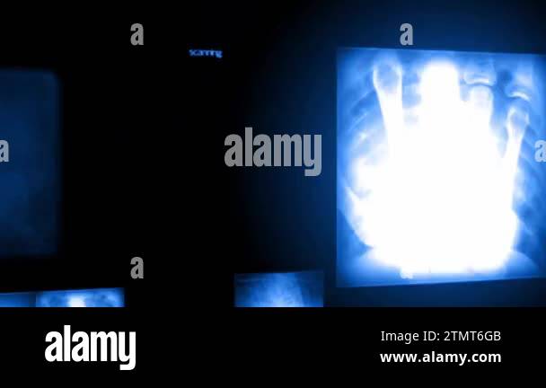 Body identification Stock Videos & Footage - HD and 4K Video Clips - Alamy