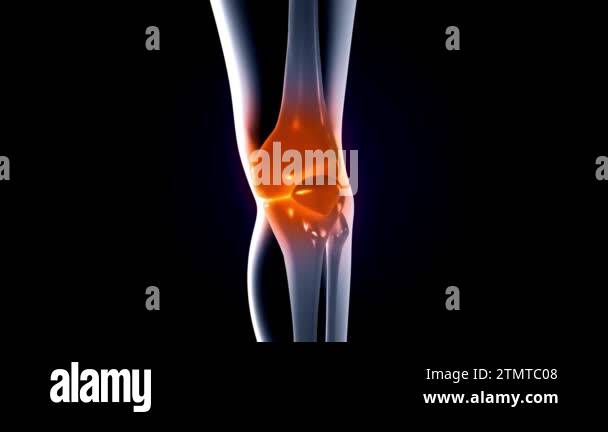 knee injury 3d rendered medical animation of the human feet bones. foot ...
