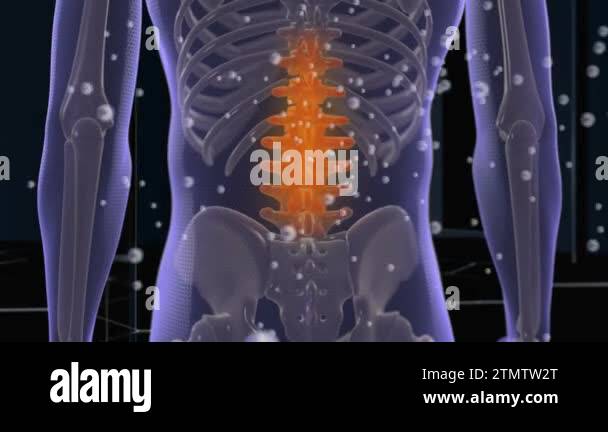 Animation background of painful back VFX Back Pain Augmented Reality ...
