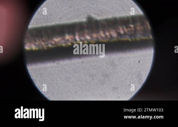 Single Human hair under a microscope. Microscopy of human hair from the ...