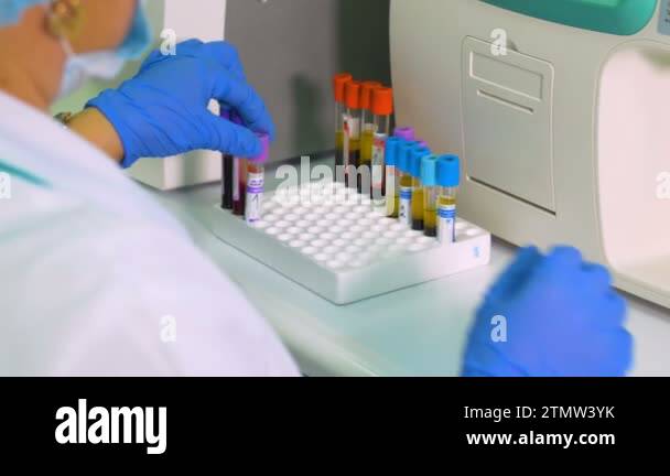 Doctor working in the modern medical laboratory. Analysis of blood ...