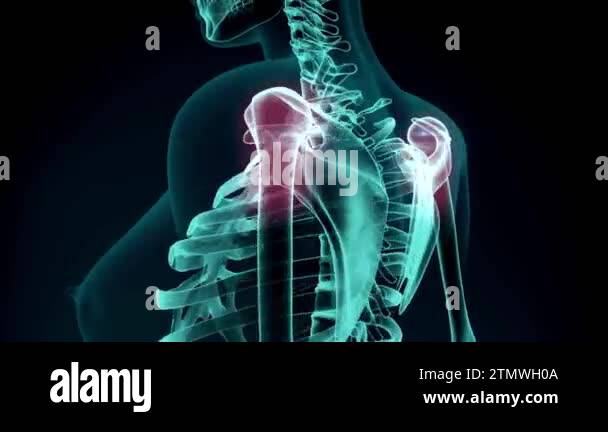 Animation background of painful back VFX Back Pain Augmented Reality ...