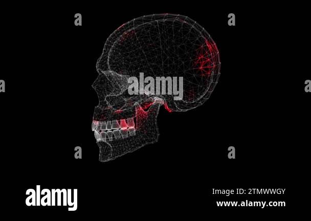 Spread of virus through 3D human skull on black background. Visual ...