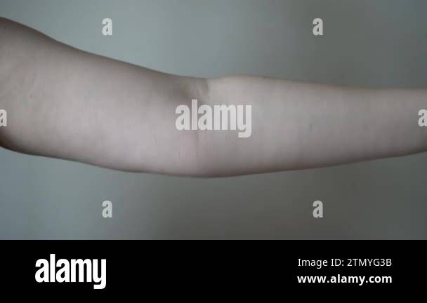 Light-skinned young woman with drooping arms. Sad bad body shape girl ...