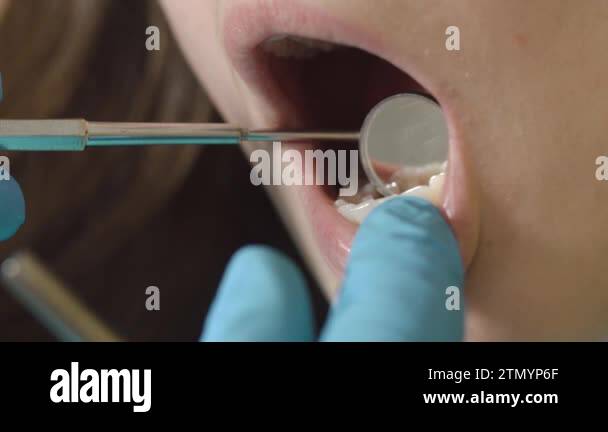 Examination Of The Mouth And Teeth. Close-up of patient young girl open ...