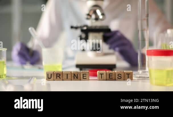 Scientist analyzes urinalysis using microscope in laboratory. Clinical ...