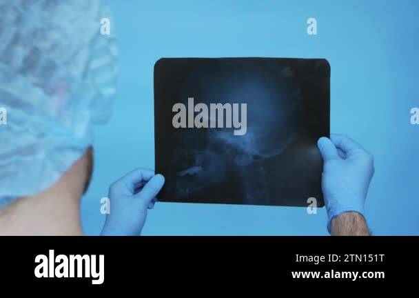 X-ray of the human brain in the doctor's hands. Radiographer A doctor ...