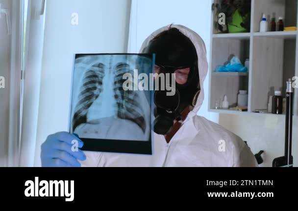 Radioactive damage to the lungs on X-ray in the laboratory. A worker in ...