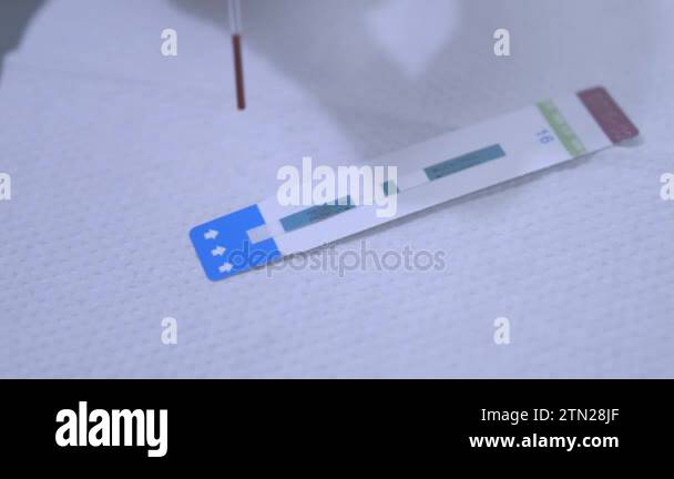 Drop blood sample on test strip. Blood testing strip. Express hiv test ...