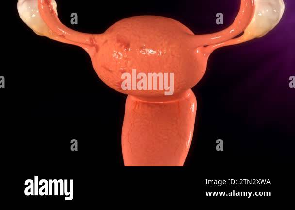 Removal of endometrial tissue on female organs Stock Video Footage - Alamy