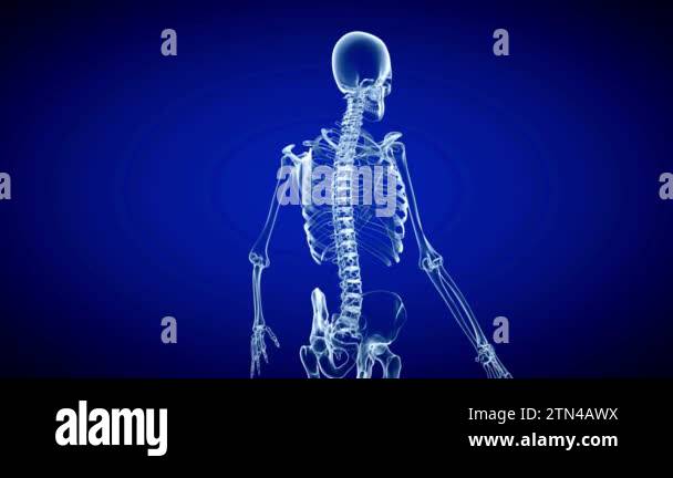 medical 3d animation of male having acute pain in the back. Human ...