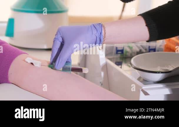 The procedure for taking blood from a patient. A nurse draws blood from ...