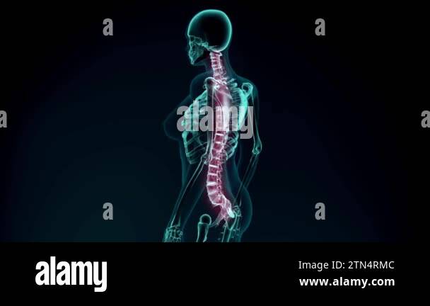 Animation background of painful back VFX Back Pain Augmented Reality ...