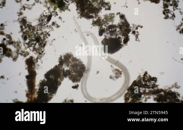 Nematode microscope Stock Videos & Footage - HD and 4K Video Clips - Alamy