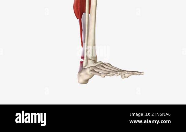 Extension fracture Stock Videos & Footage - HD and 4K Video Clips - Alamy