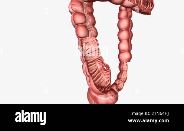 Cross section human colon Stock Videos & Footage - HD and 4K Video ...