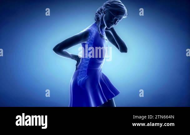 lower back spine pain Spine Trauma or Arthritis female human bone ...